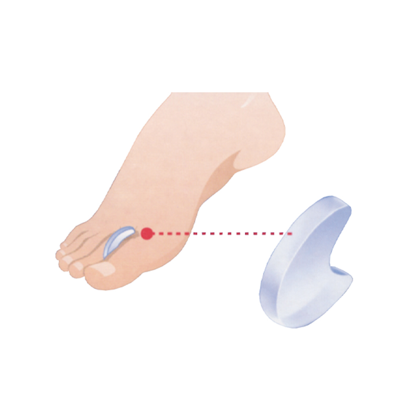 Toe Retractor — Promedics Orthopaedics